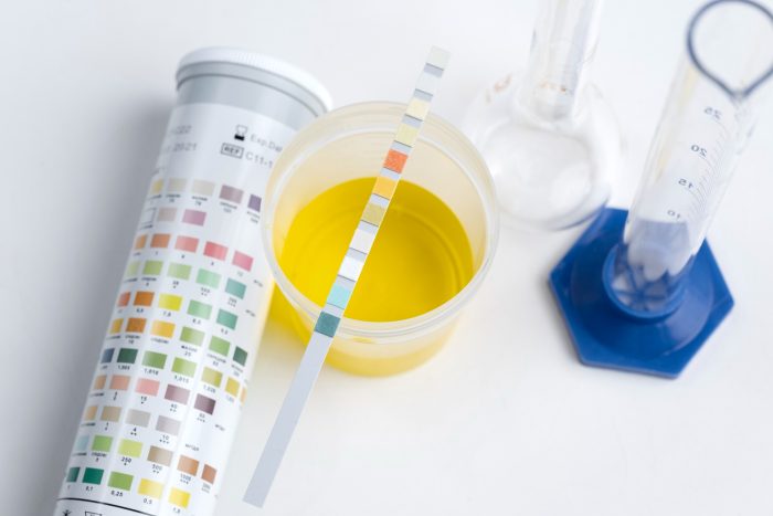 Klor ve Kloramin: Aralarındaki Fark Nedir? - Ethicwater