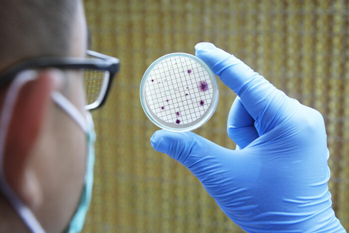 Koliform Bakteriler ve İçme Suyunda Arıtma Yöntemleri - Ethicwater